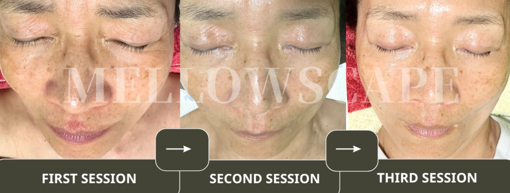 Timeless Radiance Facial | KINTSUGI SPA | English friendly Swedish ...